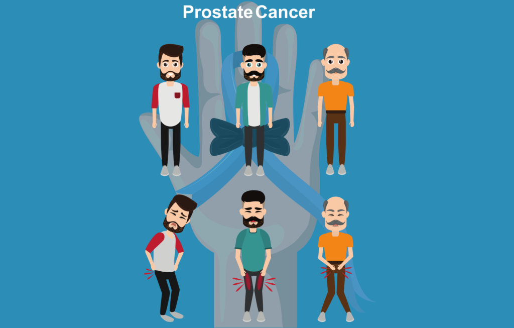 What is Prostate Cancer Screening - ReSCUE Urology Hospital Blog